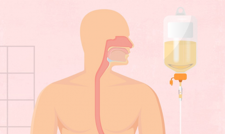 Dieta Enteral: saiba o que é e para quem é - Tudo Dietas